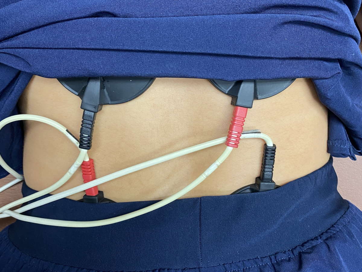 Back pain relief electrical therapy | Chiropractor Orange CA